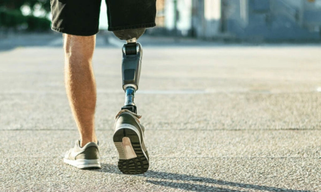 Updates – Adjustable Lower Limb Socket (ALLS)