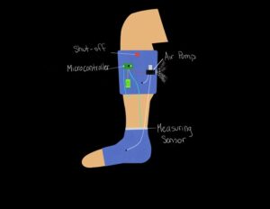 DESIGNS/UPDATES – DVT PREVENTION